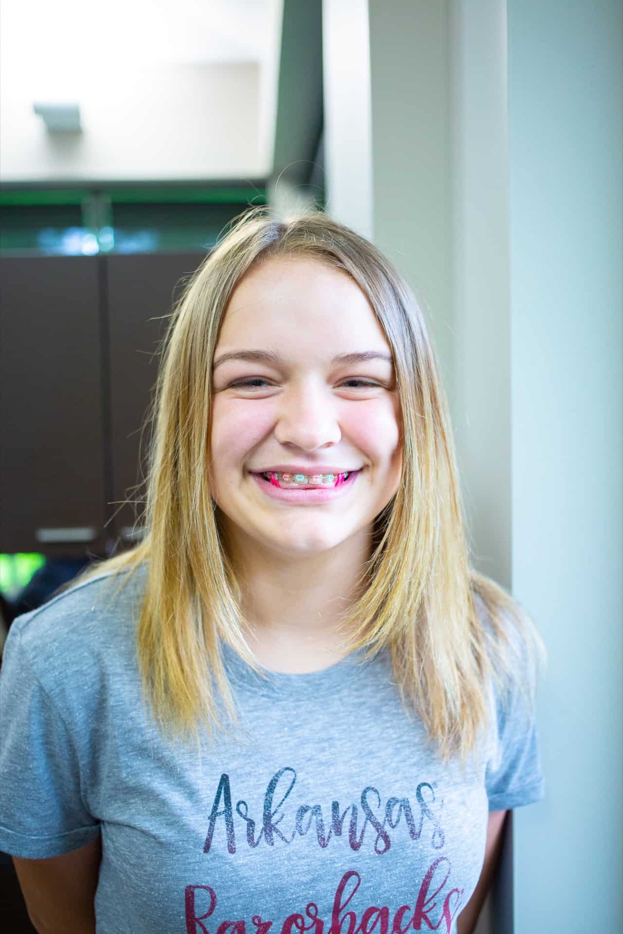 How Do I Fix My Uneven Smile? - Smith And Davis Orthodontics