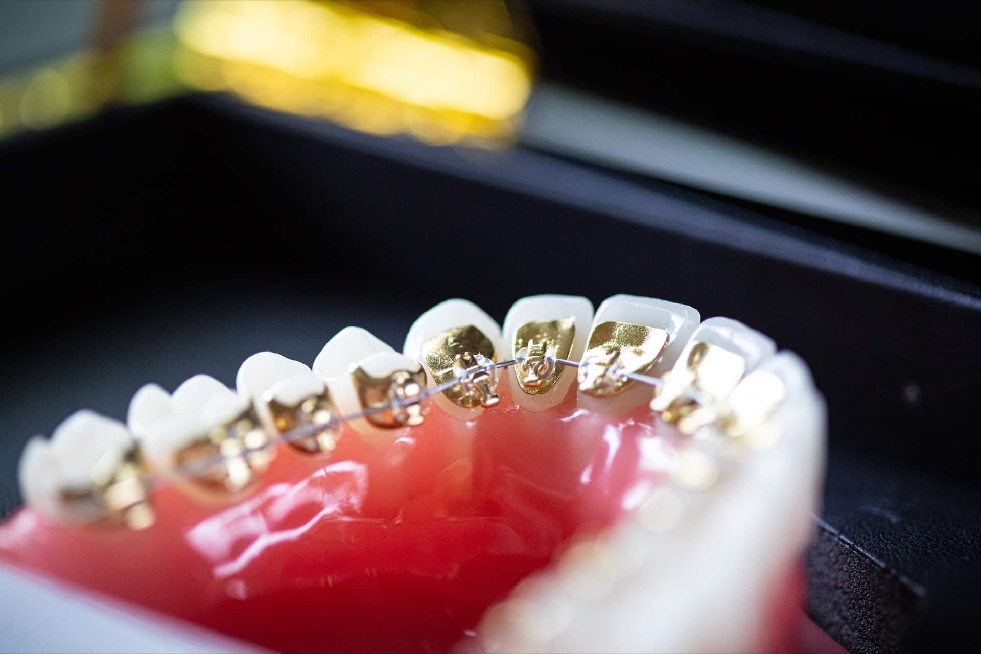 History of Teeth Straightening | Smith & Davis Orthodontics