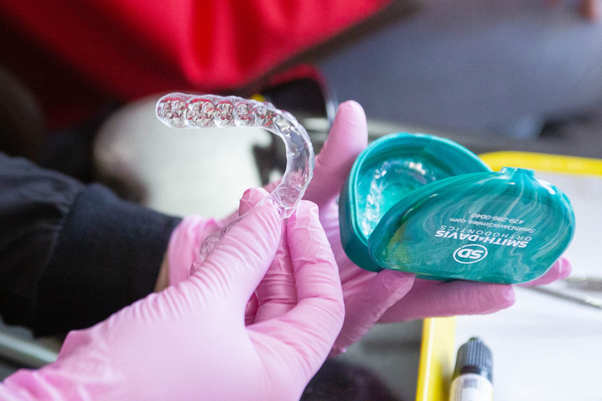 Permanent vs. Removable Retainers? Find Out! | Rogers, AR